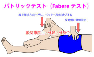 パトリックテスト(Fabere test)【股関節 or 仙腸関節の検査】